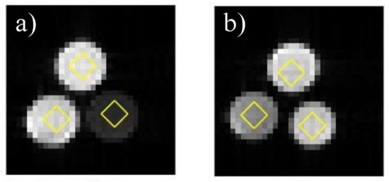 Diffusion in Sephadex Gel Structures: Time Dependency Revealed by Multi ...