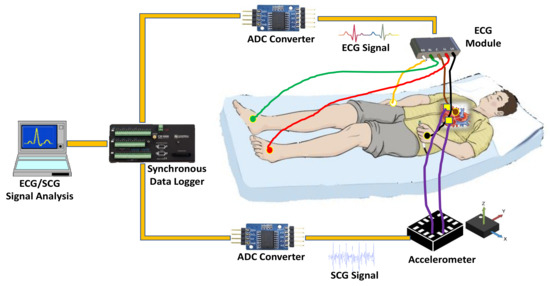 A Comprehensive Review on Seismocardiogram: Current Advancements on ...