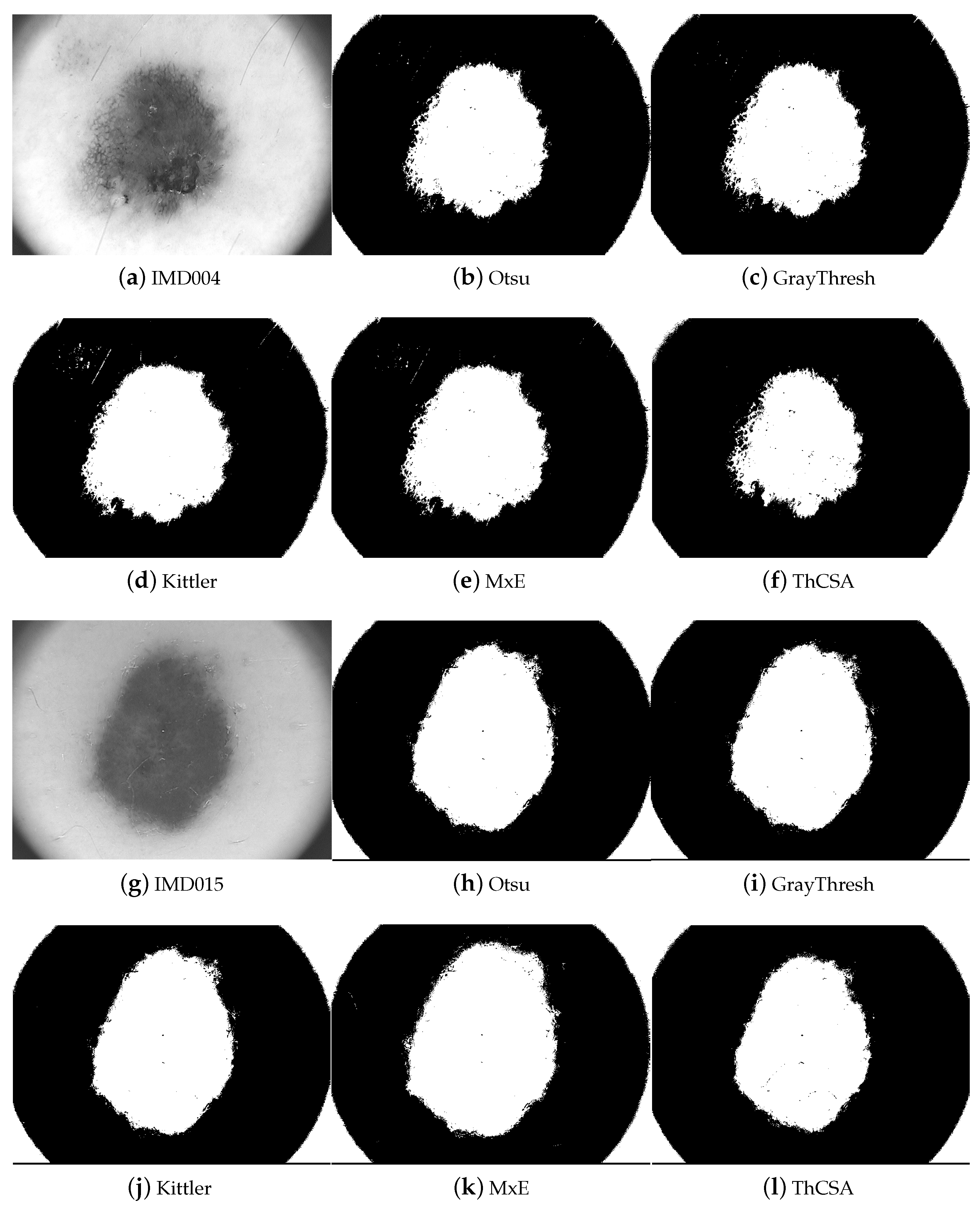 Alternative Thresholding Technique for Image Segmentation Based on Cuckoo Search and Generalized ...