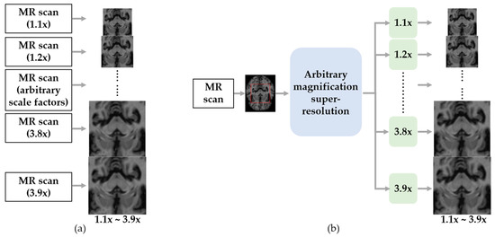 Single Image Super-Resolution with Arbitrary Magnification Based on ...