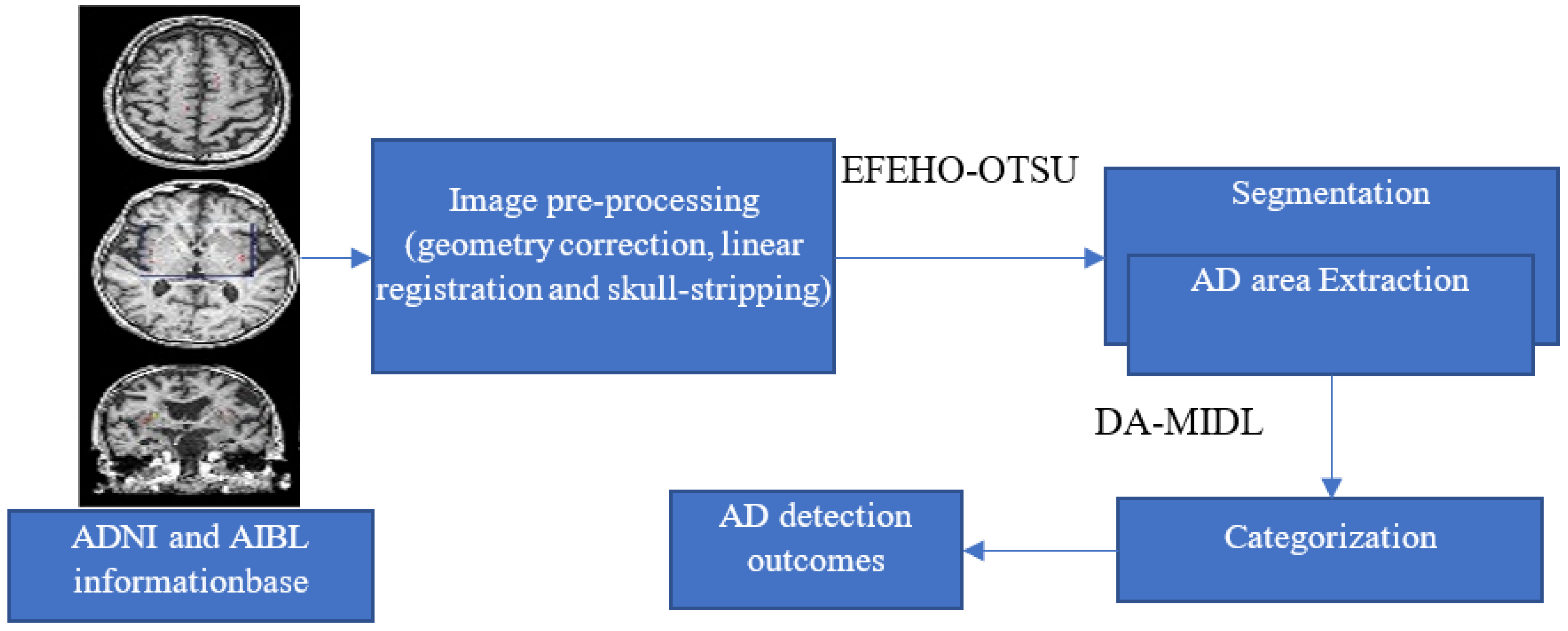 Enhanced Fuzzy Elephant Herding Optimization-Based OTSU Segmentation and Deep Learning for ...