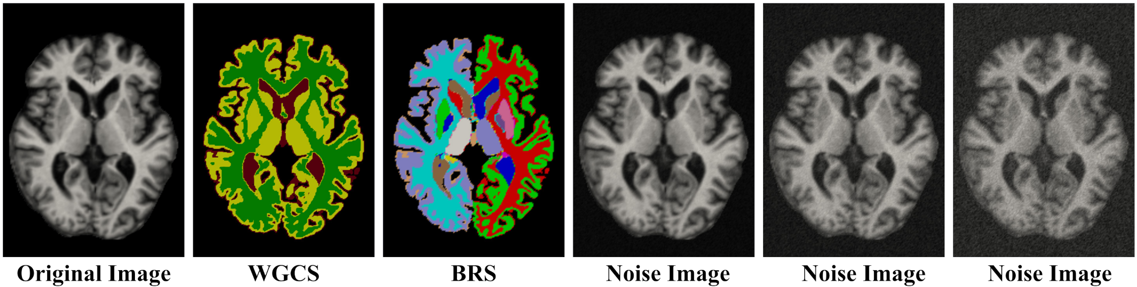 Symmetric Diffeomorphic Image Registration with Multi-Label Segmentation Masks