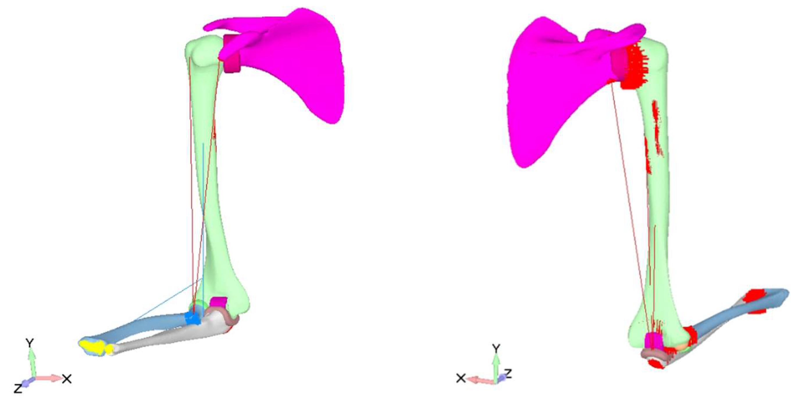 Mechanical Model and FEM Simulations for Efforts on Biceps and Triceps ...