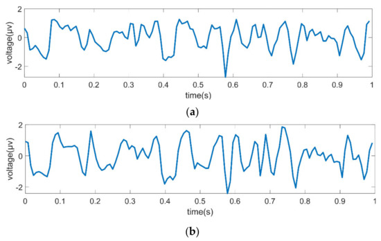 Multi-Channel EEG Emotion Recognition Based on Parallel Transformer and 3D-Convolutional Neural ...