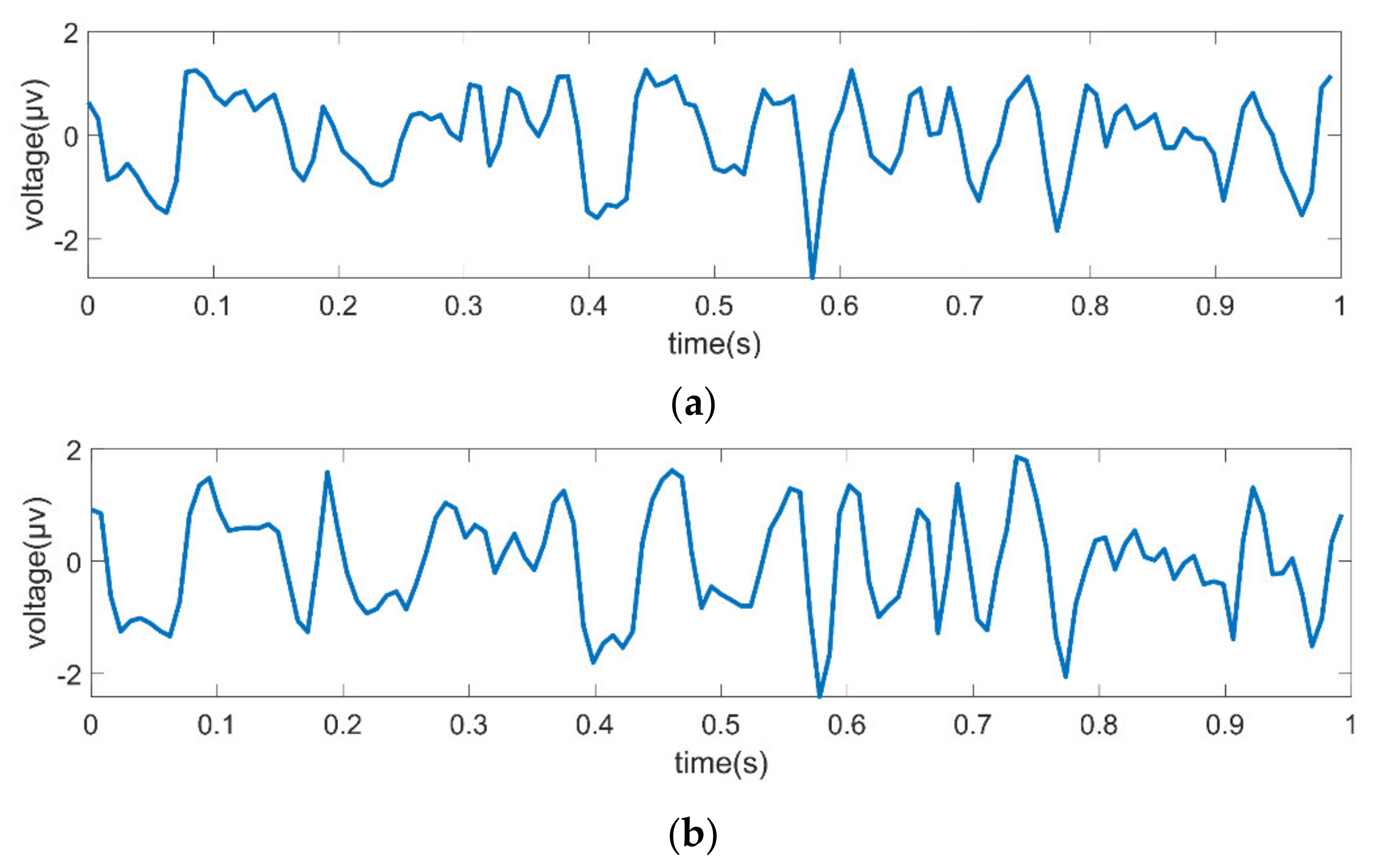 Multi-Channel EEG Emotion Recognition Based on Parallel Transformer and ...