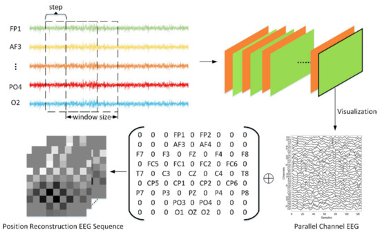Multi-Channel EEG Emotion Recognition Based on Parallel Transformer and 3D-Convolutional Neural ...