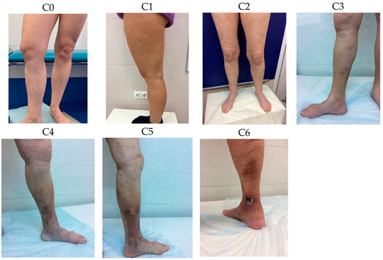 Mathematics | Free Full-Text | Deep Learning Approaches to Automatic ...