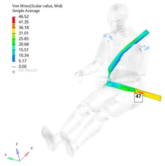 Effects of Seat Belts and Shock Absorbers on the Safety of Racing Car ...