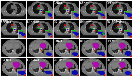 Mathematics | Free Full-Text | FAS-UNet: A Novel FAS-Driven UNet to Learn Variational Image ...