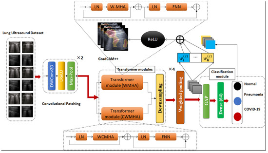 Interpretable Deep Learning for Discriminating Pneumonia from Lung ...
