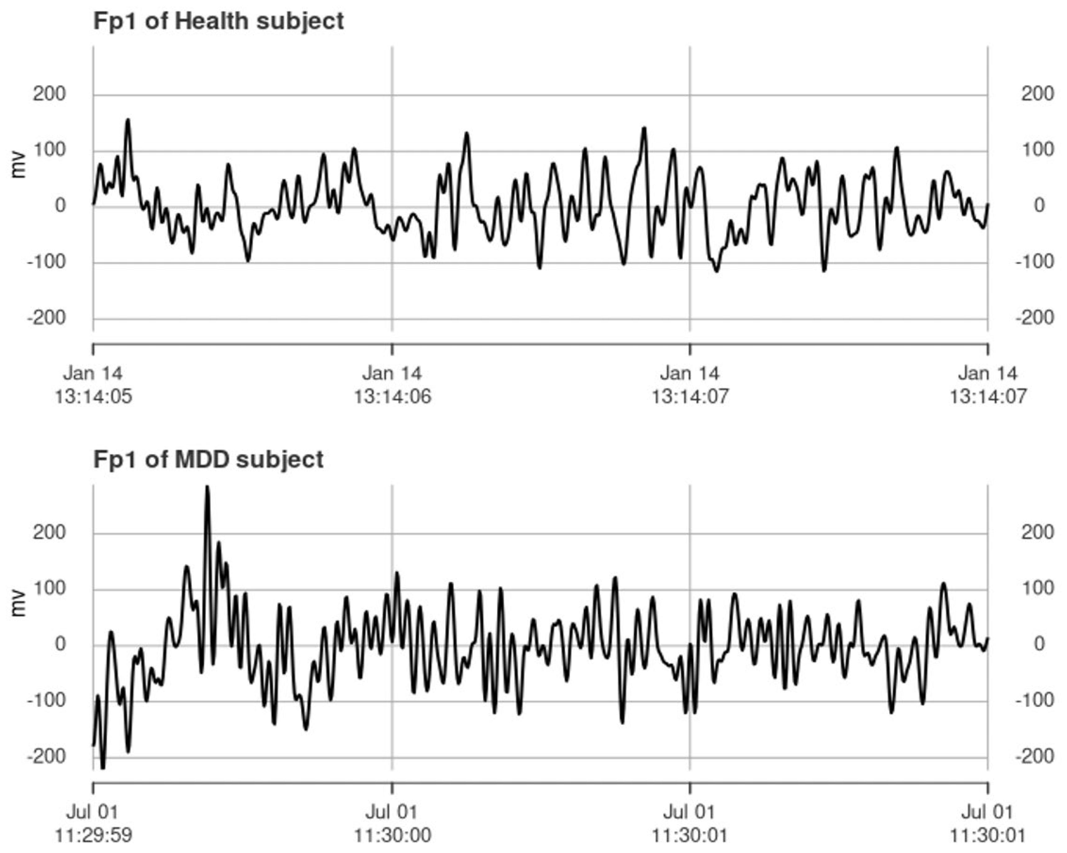 Detecting Depression Using Single-Channel EEG and Graph Methods Detecting Depression Using Single-Channel EEG and Graph Methods