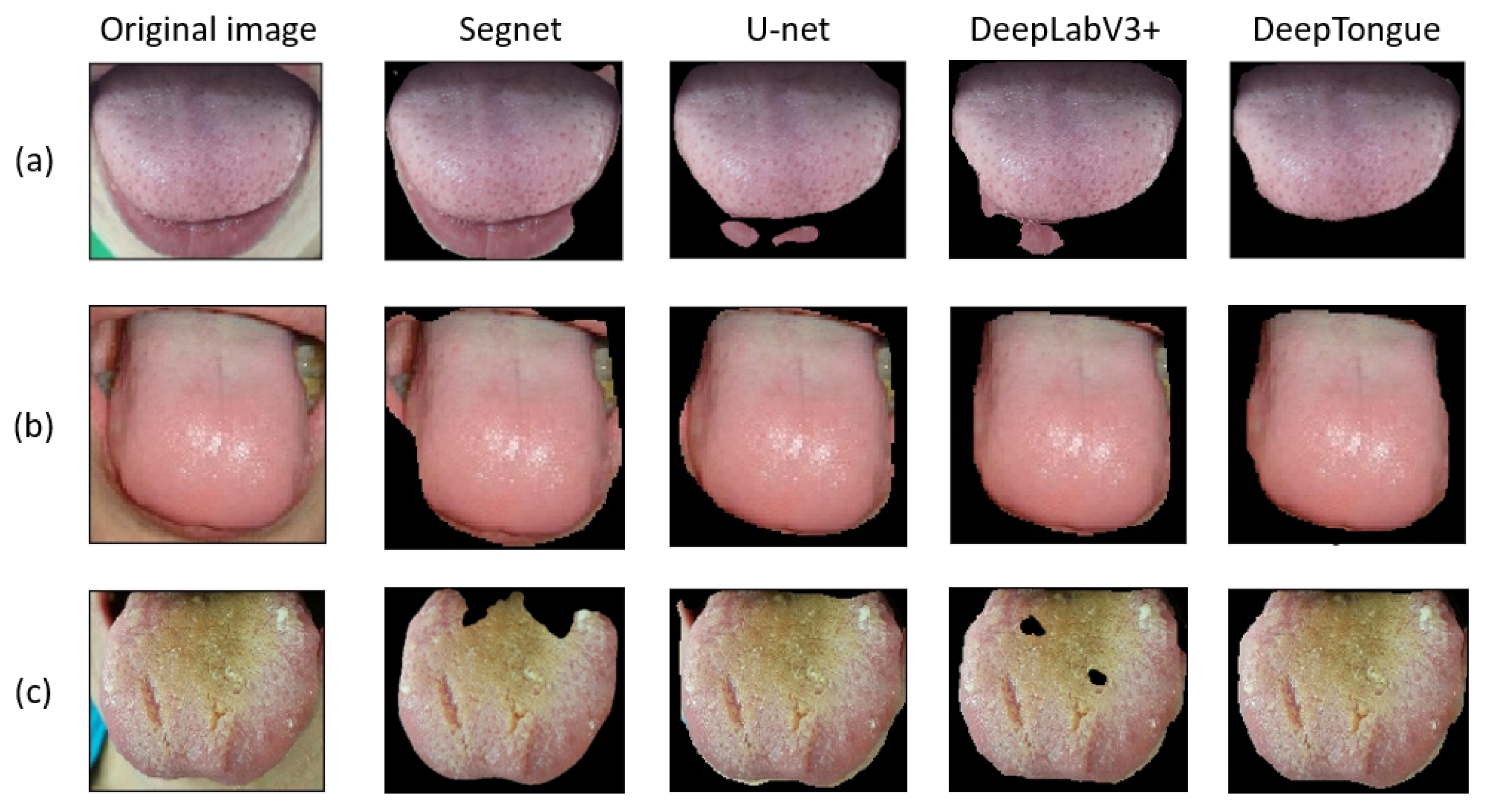 Tongue Segmentation and Color Classification Using Deep Convolutional Neural Networks
