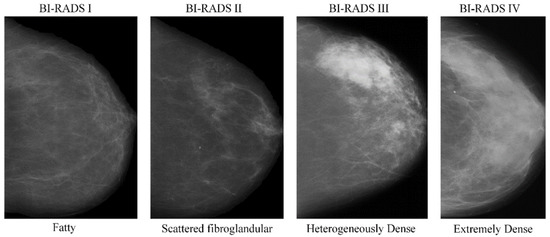 TwoViewDensityNet: Two-View Mammographic Breast Density Classification Based on Deep ...