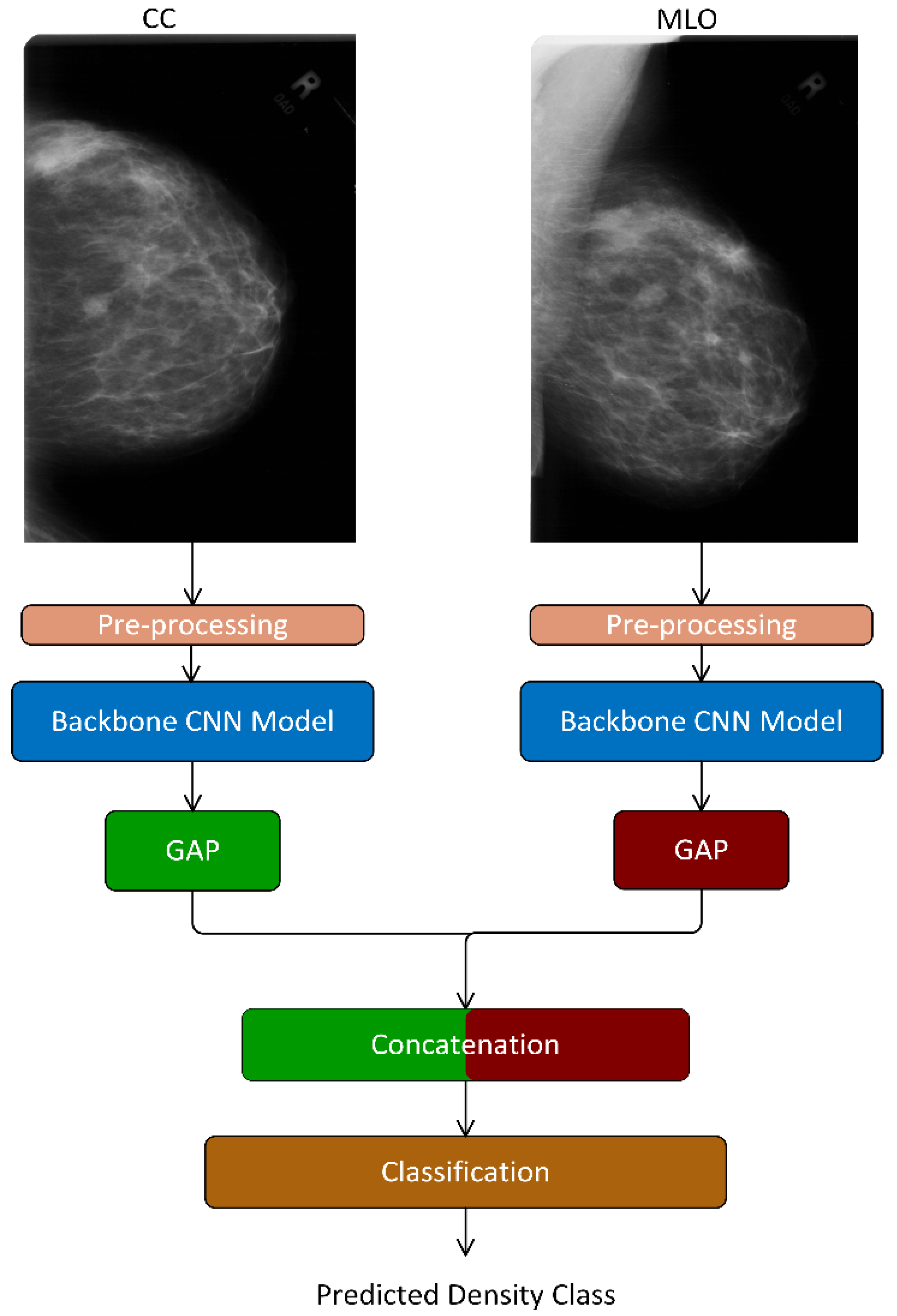 TwoViewDensityNet: Two-View Mammographic Breast Density Classification Based on Deep ...