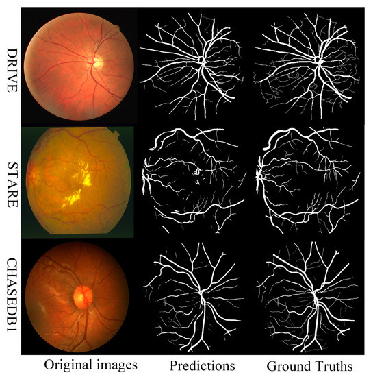 Deep Multi-Task Learning for an Autoencoder-Regularized Semantic ...