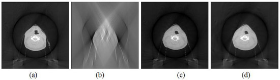 Reconstructing a 3D Medical Image from a Few 2D Projections Using a B ...