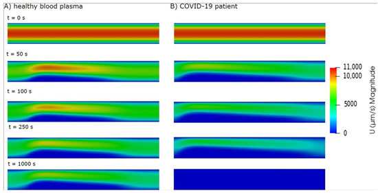 Combining Computational Modelling and Machine Learning to Identify COVID-19 Patients with a High ...