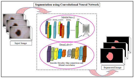 Mathematics | Free Full-Text | DeepLabv3+-Based Segmentation and Best Features Selection Using ...