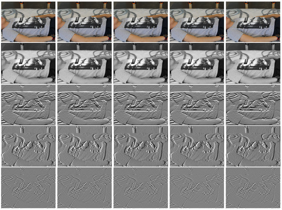 Non-Contact Breathing Rate Estimation Using Machine Learning with an Optimized Architecture
