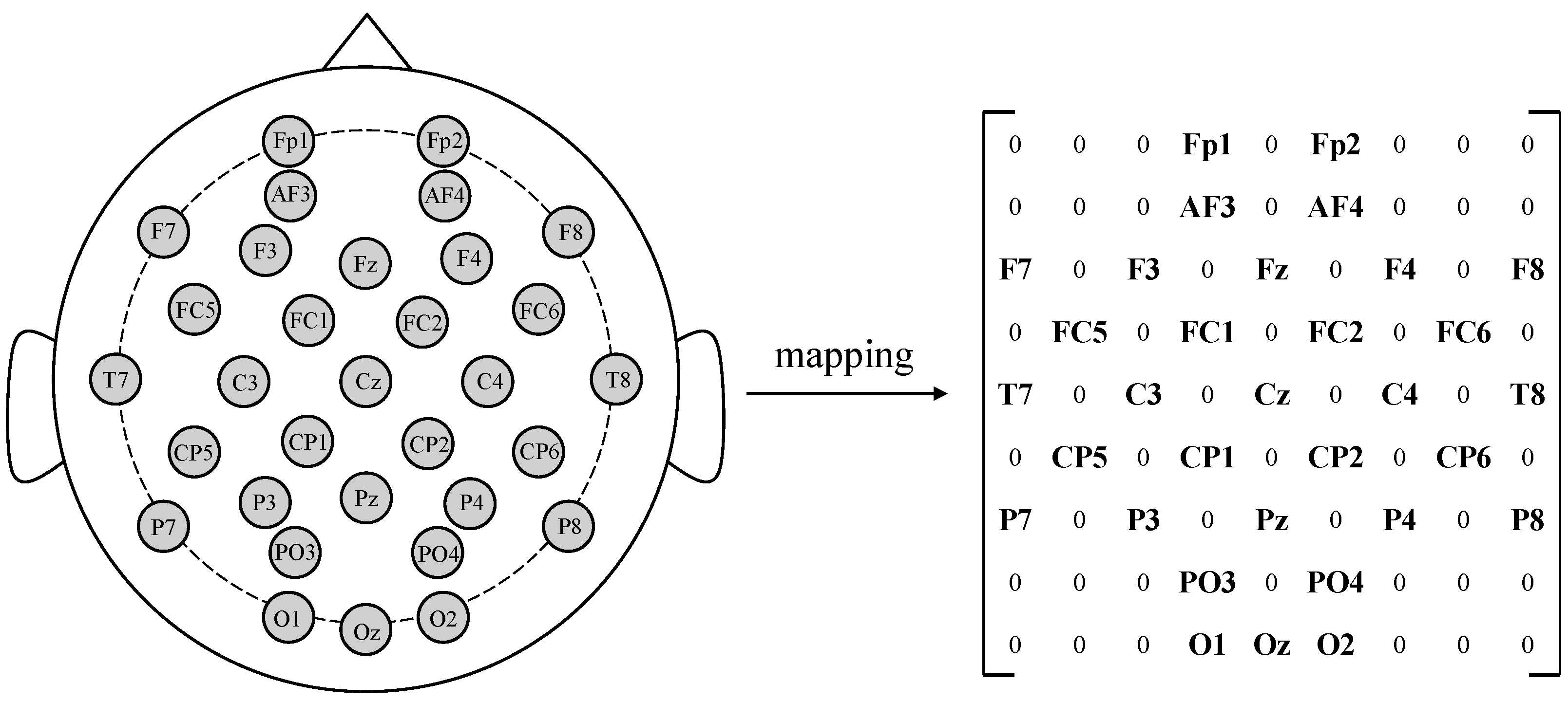 EEG-Based Emotion Recognition via Knowledge-Integrated Interpretable Method