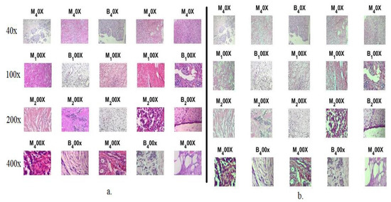 Multi-Method Diagnosis of Histopathological Images for Early Detection ...