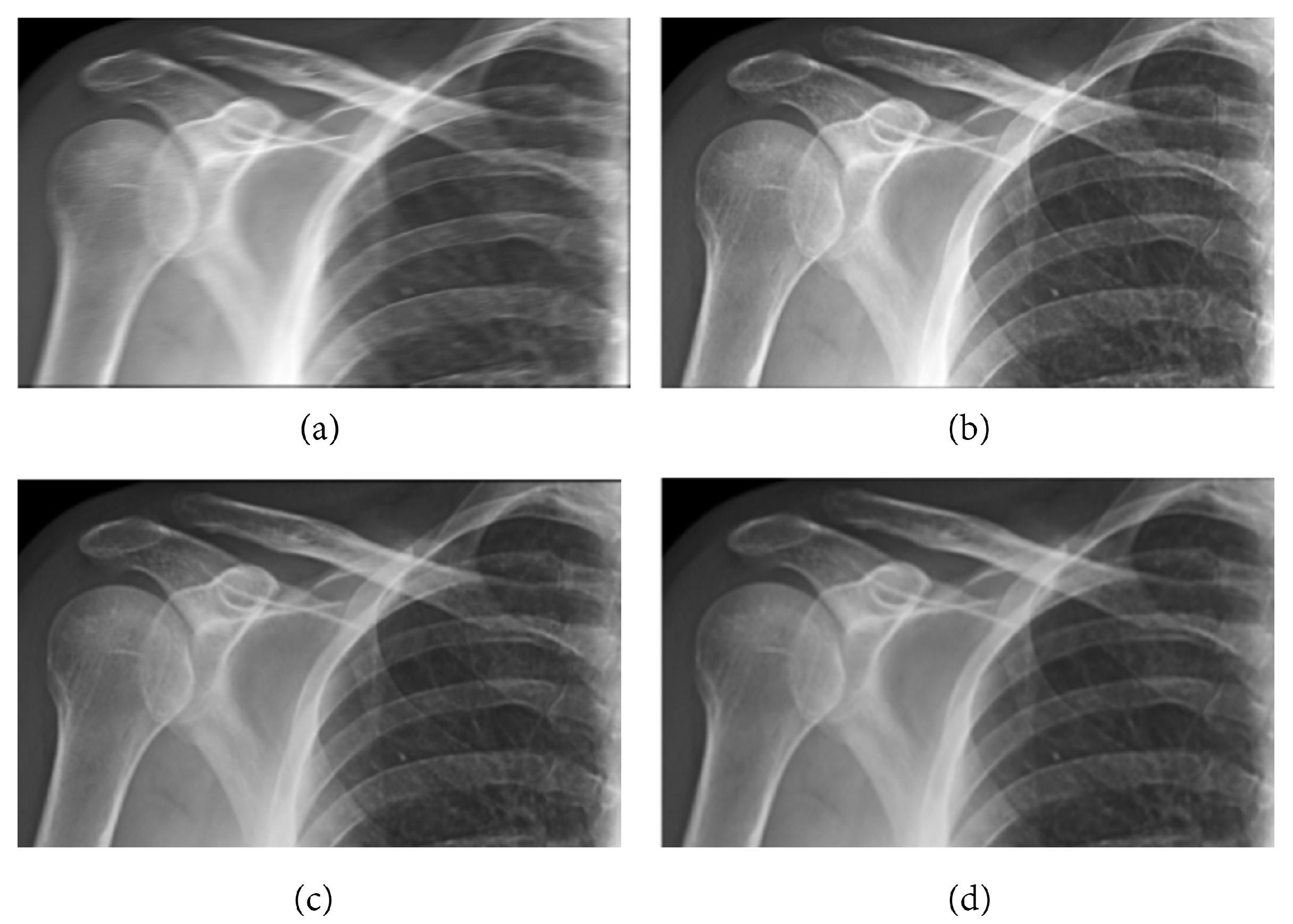 An Inertial Forward–Backward Splitting Method for Solving Modified Variational Inclusion ...