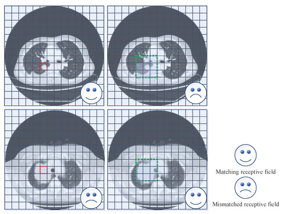 ELCT-YOLO: An Efficient One-Stage Model for Automatic Lung Tumor ...