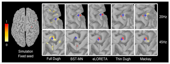 Robust Evaluation and Comparison of EEG Source Localization Algorithms for Accurate ...
