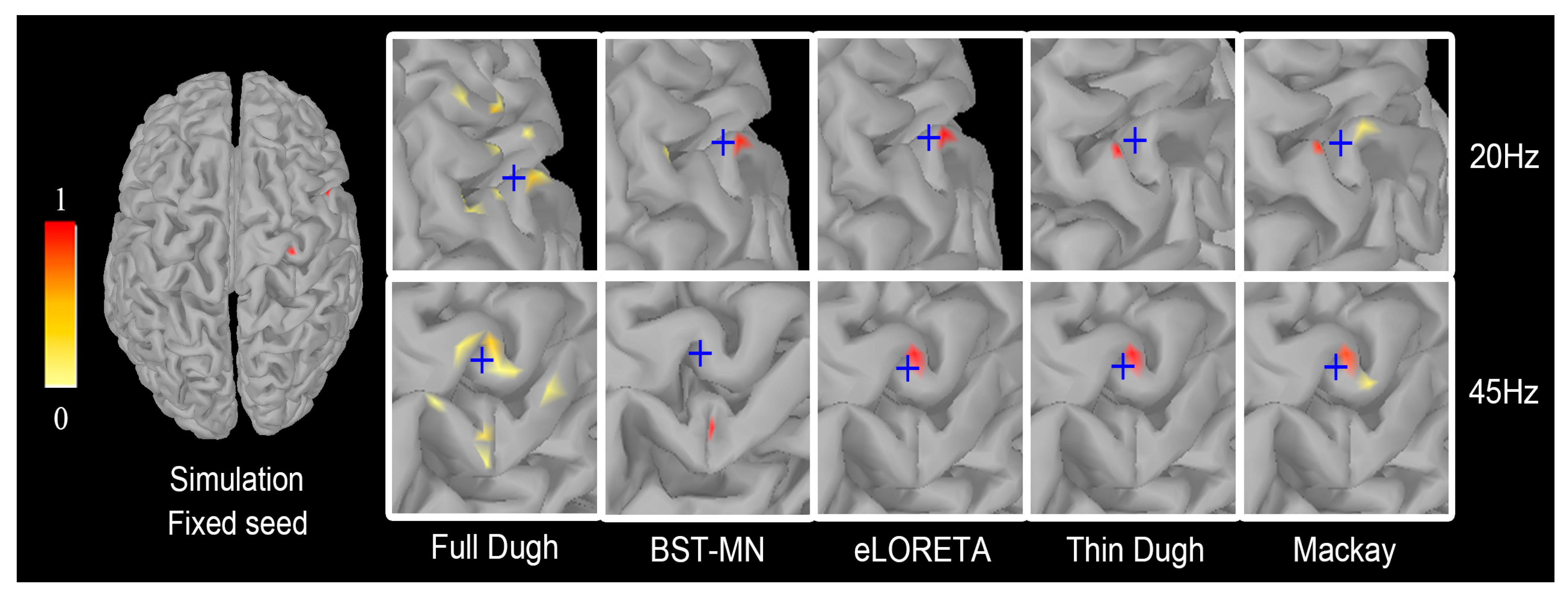 Robust Evaluation and Comparison of EEG Source Localization Algorithms ...