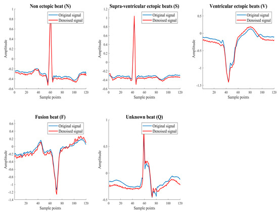 Combining the Taguchi Method and Convolutional Neural Networks for Arrhythmia Classification by ...