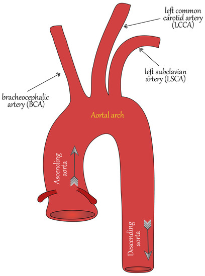 Numerical Method for Geometrical Feature Extraction and Identification of Patient-Specific Aorta ...
