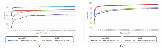 A Novel Light U-Net Model for Left Ventricle Segmentation Using MRI