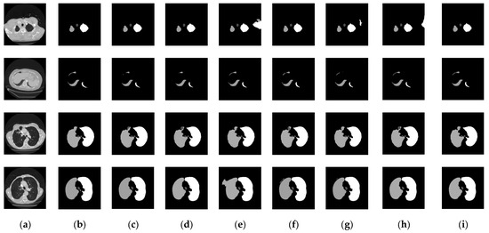 A Method of Lung Organ Segmentation in CT Images Based on Multiple Residual Structures and an ...