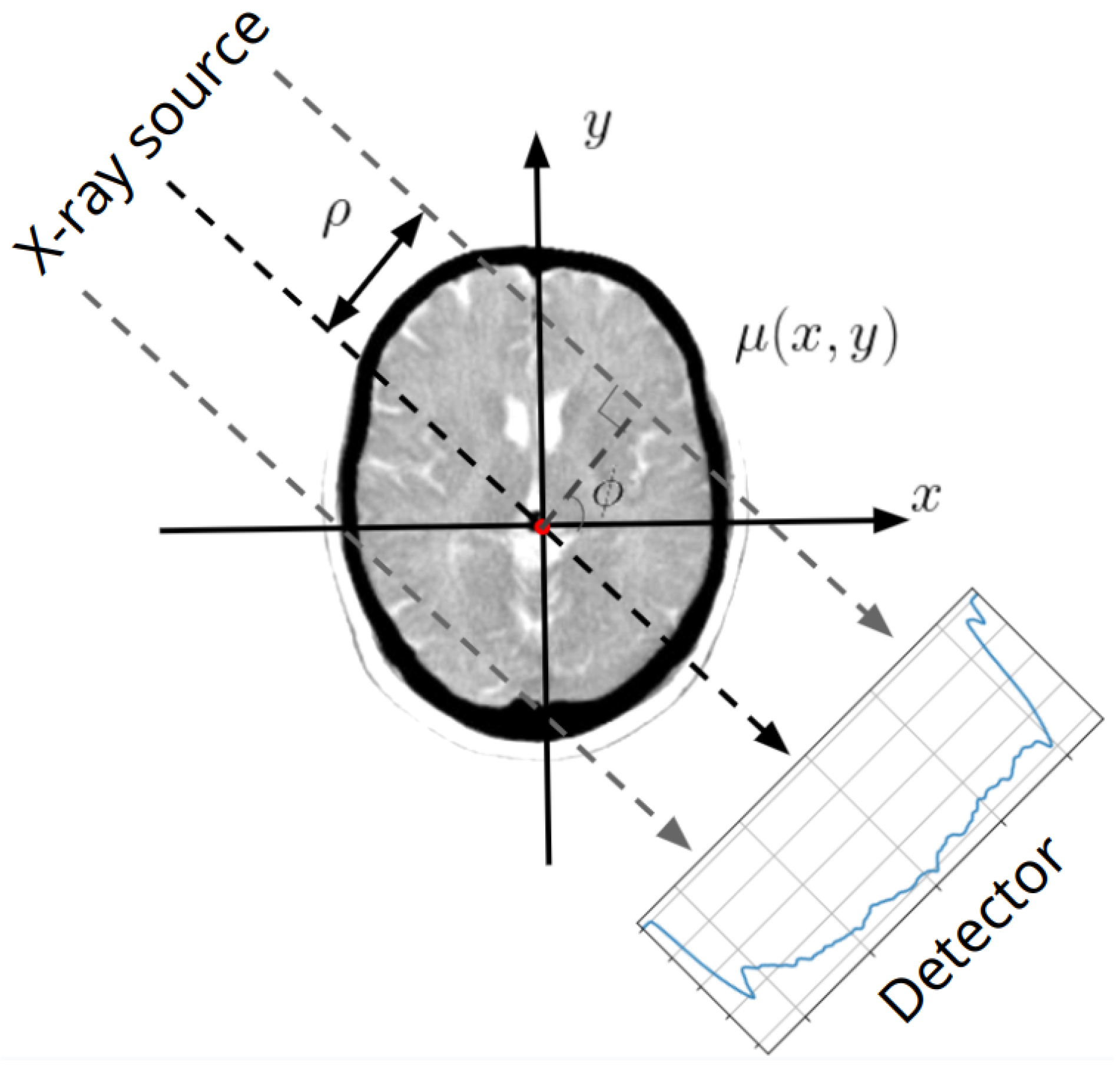 Tomographic Reconstruction: General Approach to Fast Back-Projection Algorithms