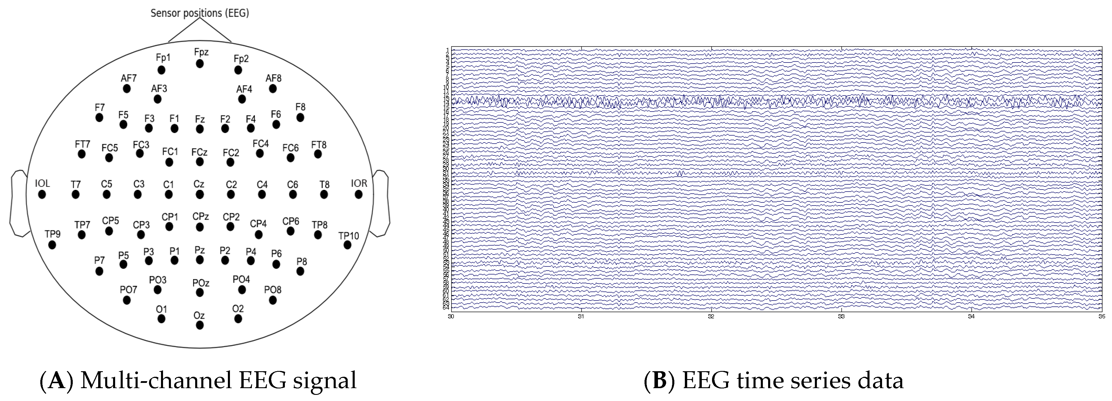 Mathematics | Free Full-Text | A Deep Learning Neural Network Method Using Linear Eigenvalue ...