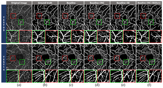 One-Shot Learning for Optical Coherence Tomography Angiography Vessel ...