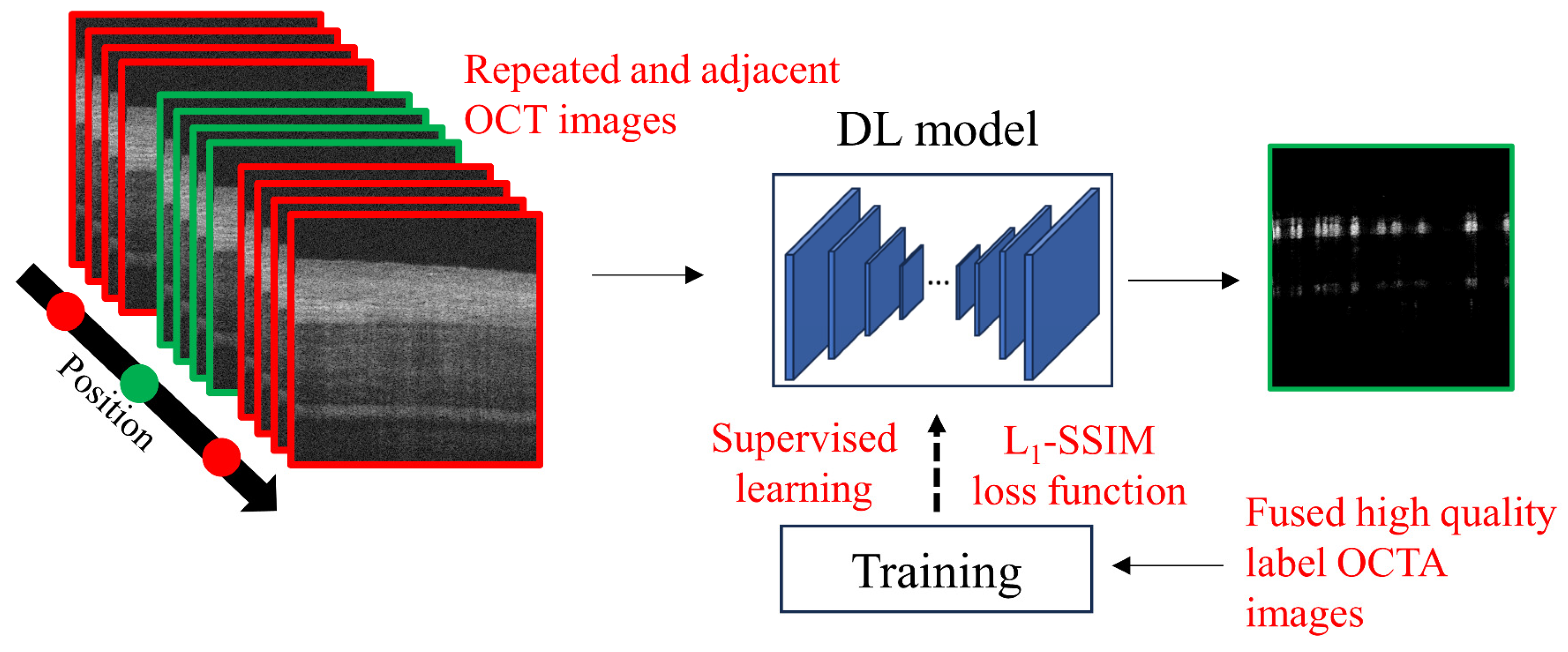 Deep Learning for Motion Artifact-Suppressed OCTA Image Generation from ...