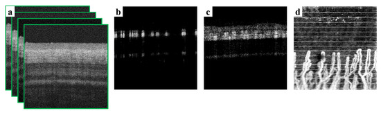 Deep Learning for Motion Artifact-Suppressed OCTA Image Generation from ...