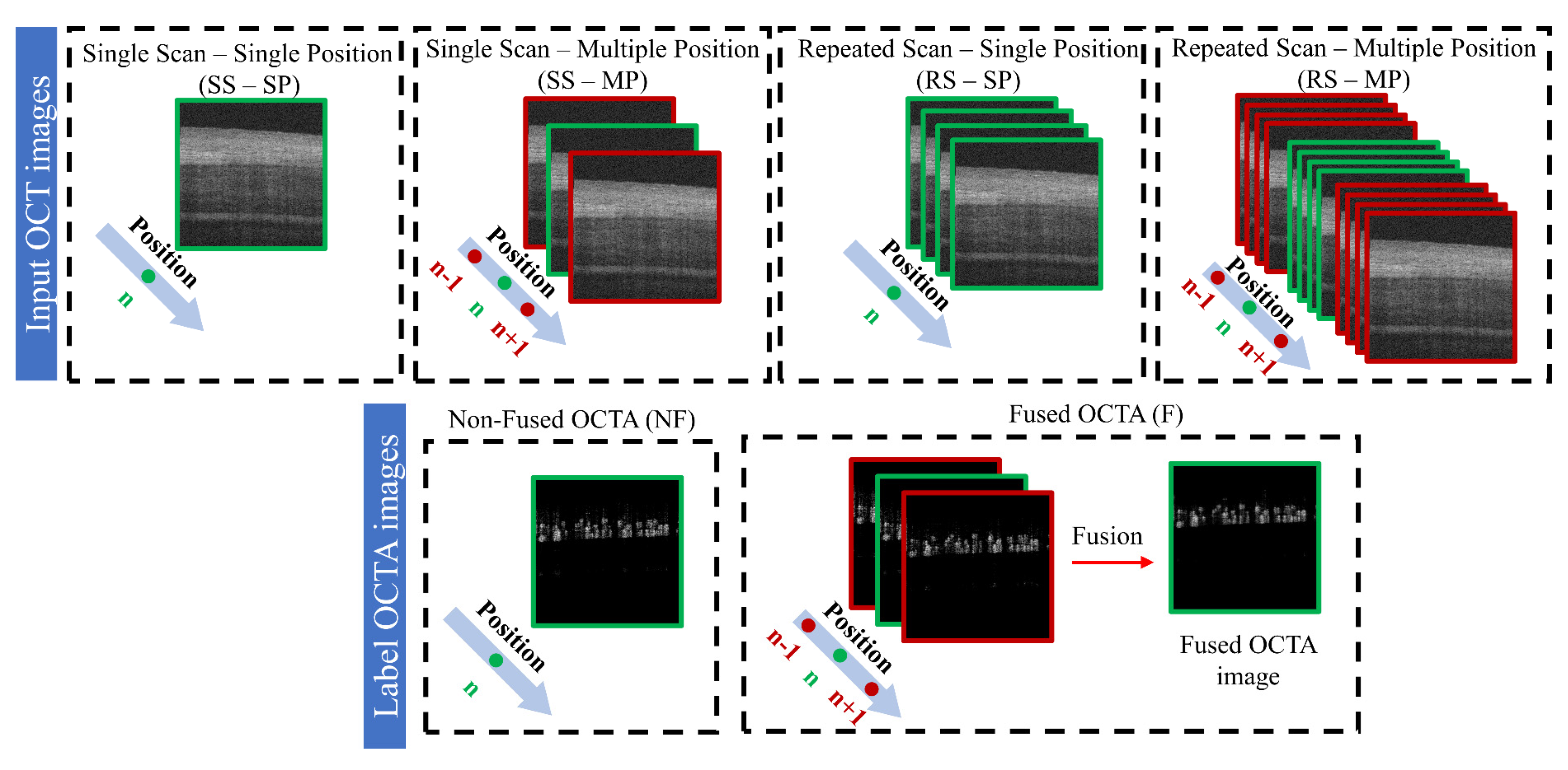 Deep Learning for Motion Artifact-Suppressed OCTA Image Generation from ...