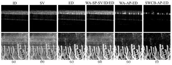 Deep Learning for Motion Artifact-Suppressed OCTA Image Generation from ...