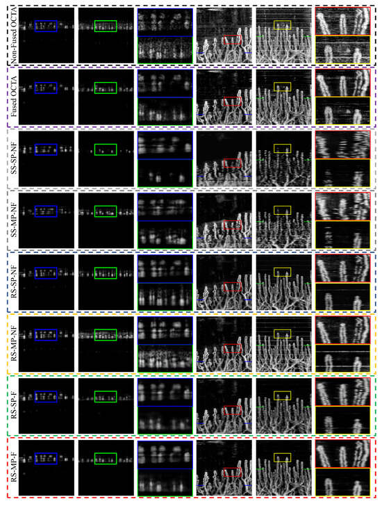 Deep Learning for Motion Artifact-Suppressed OCTA Image Generation from ...