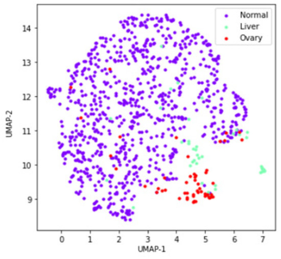 Decision-Making on the Diagnosis of Oncological Diseases Using Cost-Sensitive SVM Classifiers ...