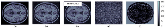 Research and Implementation of Denoising Algorithm for Brain MRIs via ...