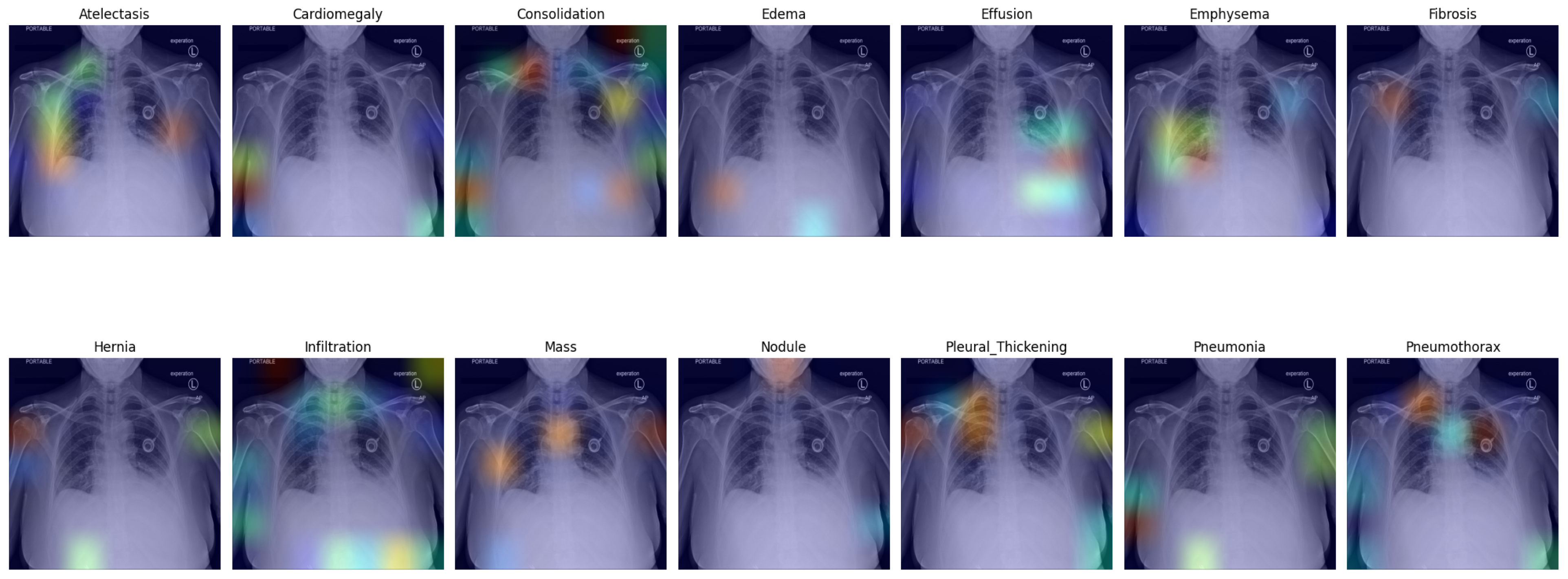 Developing New Fully Connected Layers for Convolutional Neural Networks ...