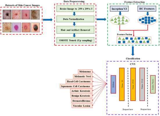 SNC_Net: Skin Cancer Detection by Integrating Handcrafted and Deep ...