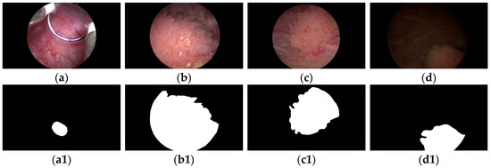 MDER-Net: A Multi-Scale Detail-Enhanced Reverse Attention Network for ...