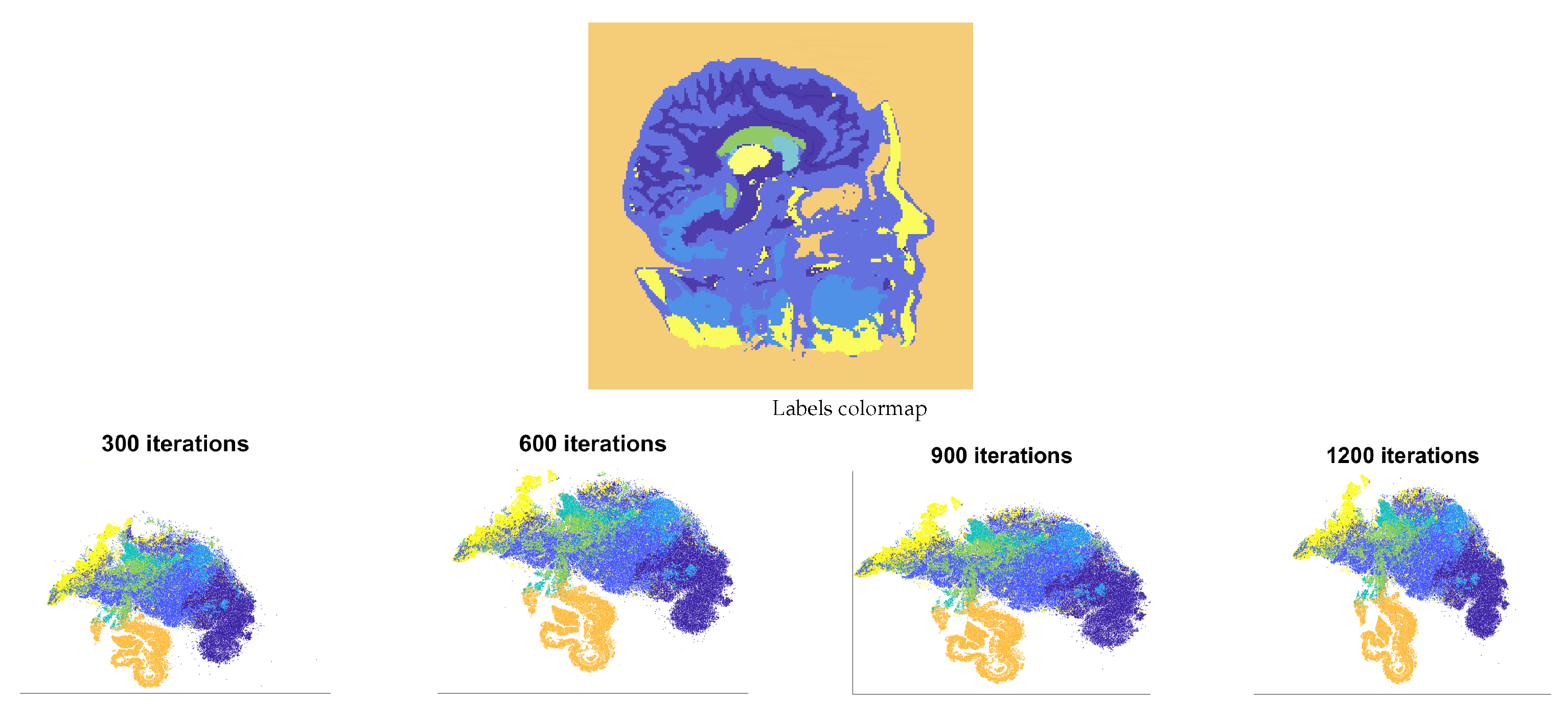 Fast Semi-Supervised t-SNE for Transfer Function Enhancement in Direct Volume Rendering-Based ...