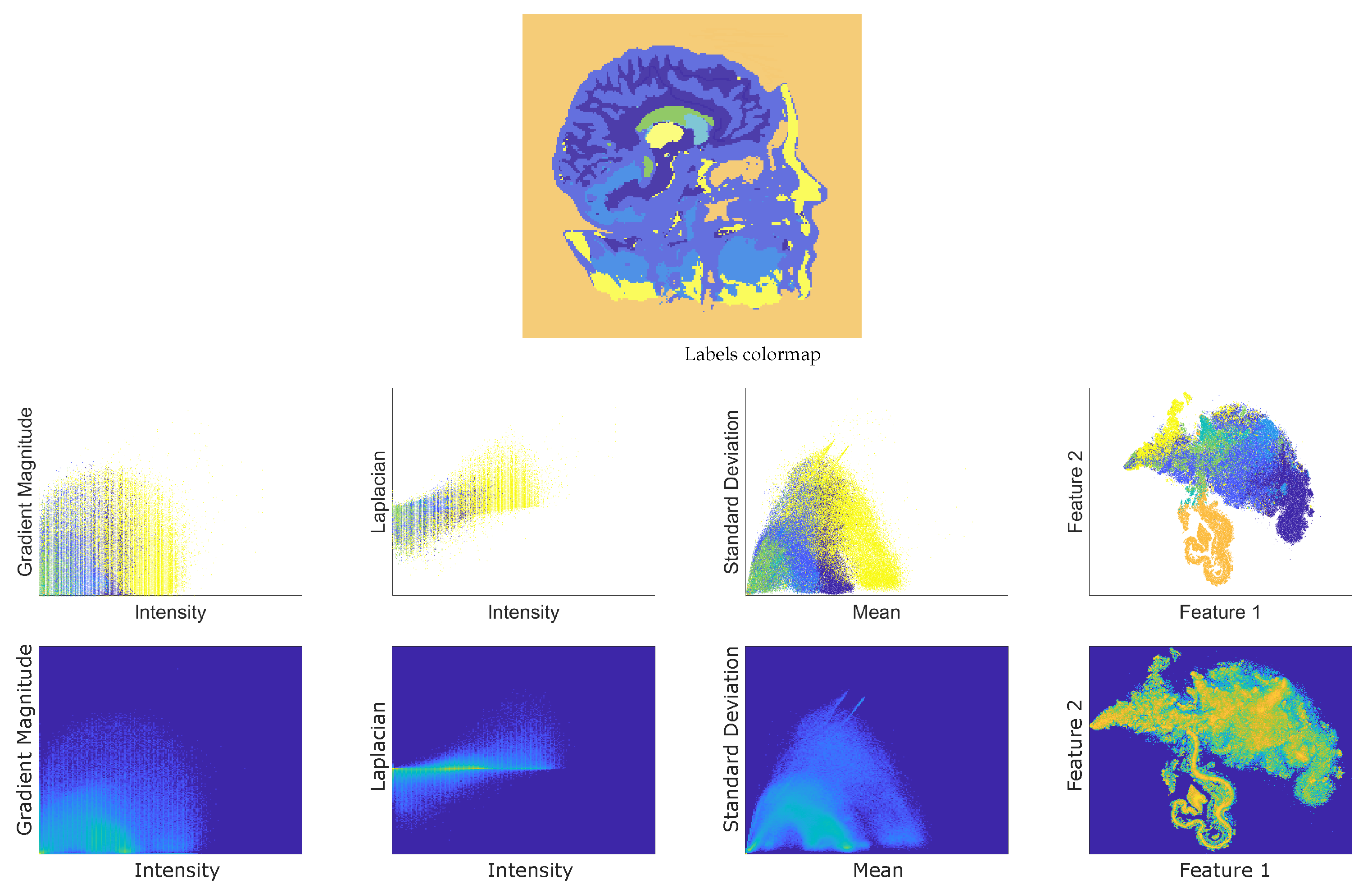 Fast Semi-Supervised t-SNE for Transfer Function Enhancement in Direct Volume Rendering-Based ...
