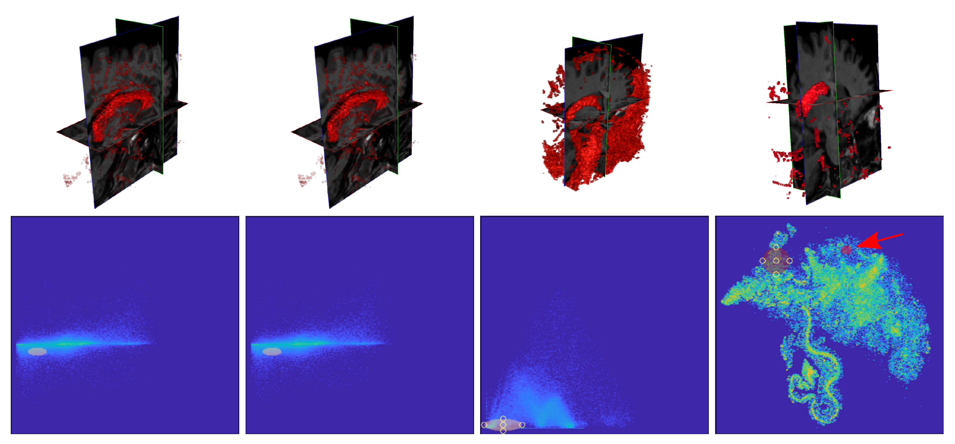 Fast Semi-Supervised t-SNE for Transfer Function Enhancement in Direct Volume Rendering-Based ...