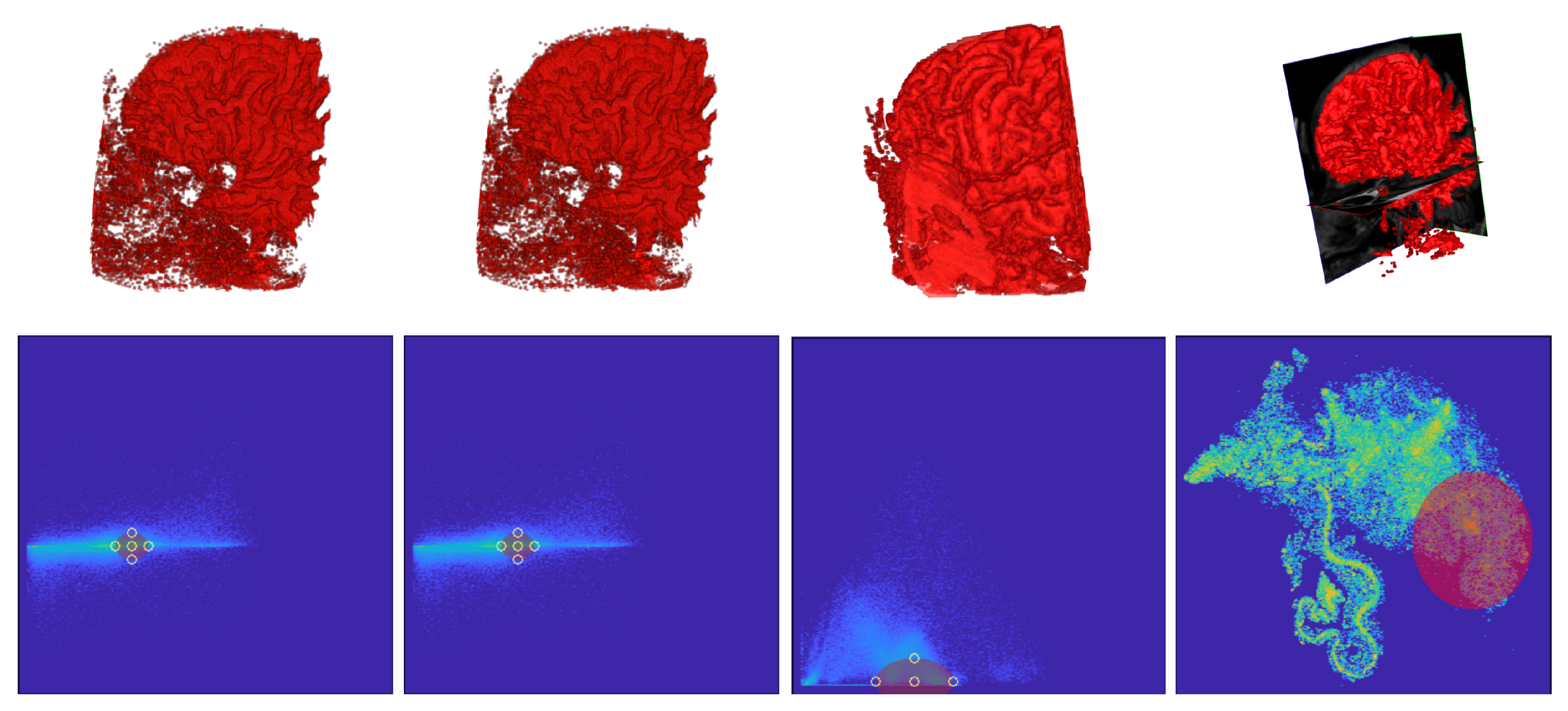 Fast Semi-Supervised t-SNE for Transfer Function Enhancement in Direct Volume Rendering-Based ...